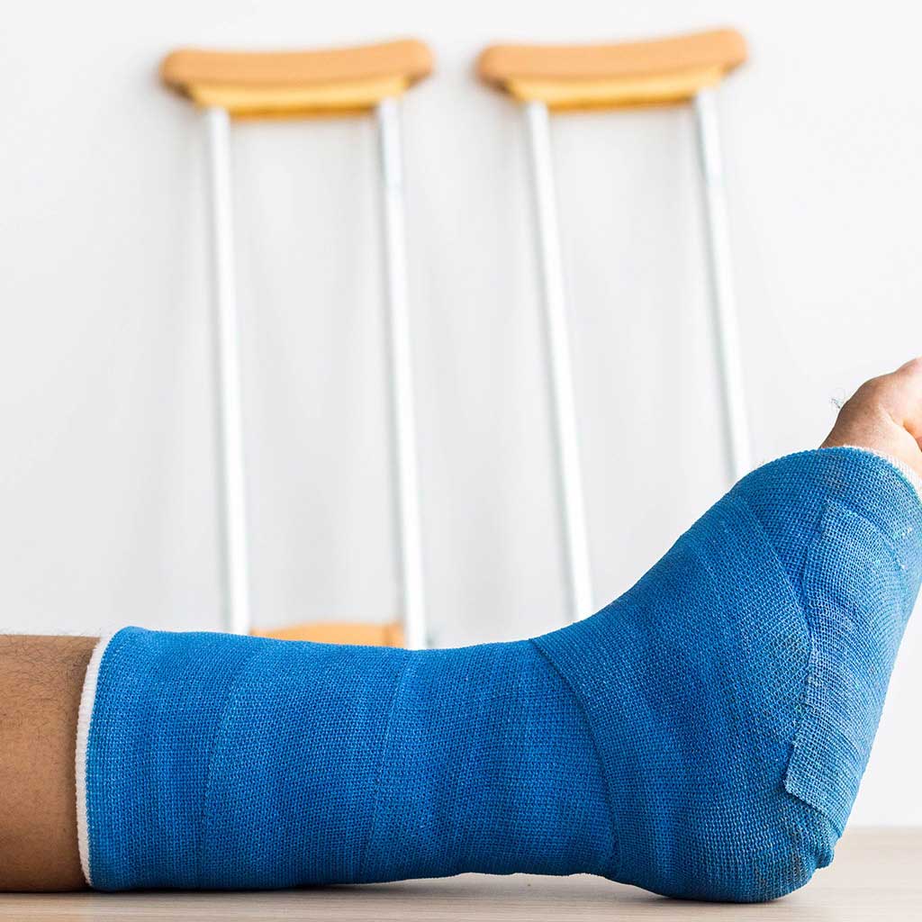 Foot & Ankle Trauma | Moore, Edmund, OK | OK Foot & Ankle Specialist