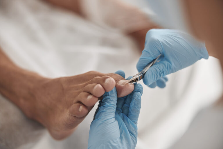 When to See a Doctor for an Ingrown Toenail: Signs and Symptoms ...